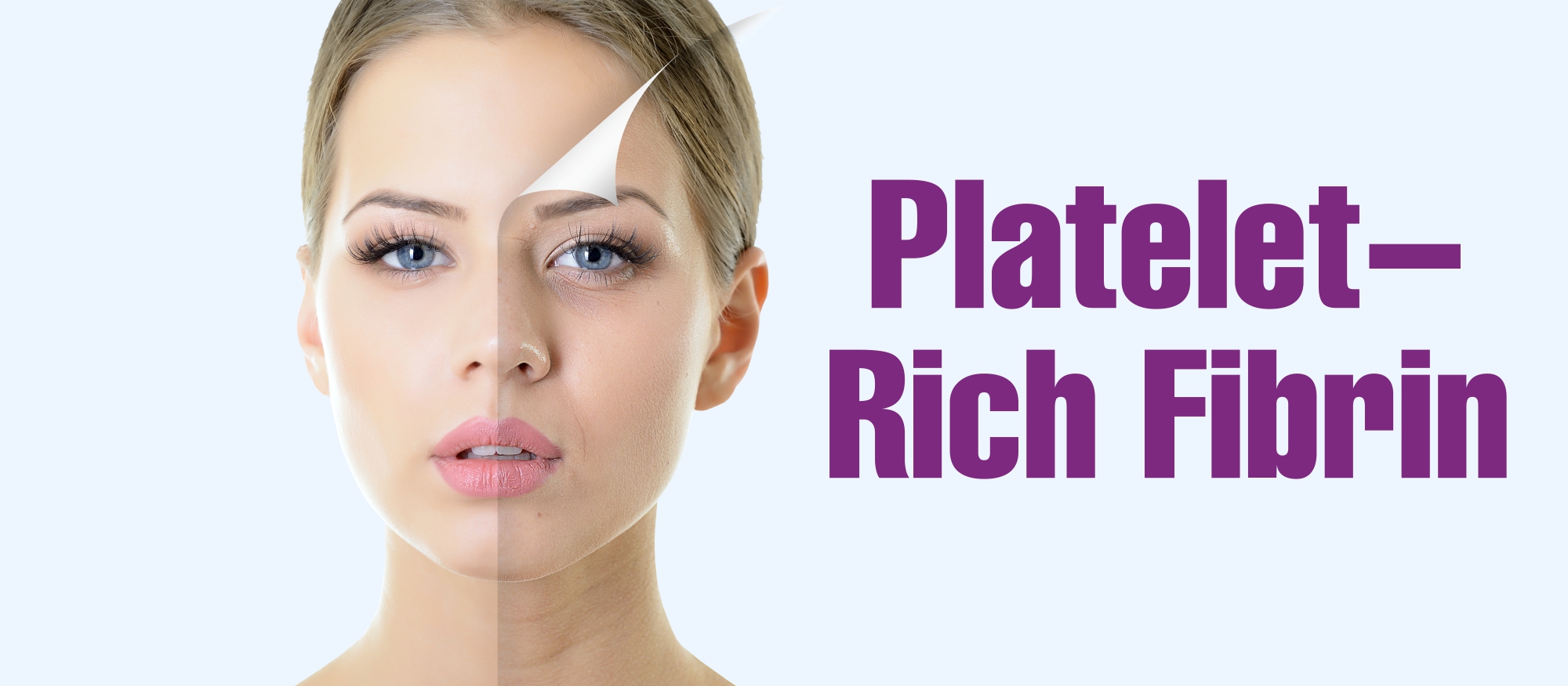 Platelet-Rich Fibrin Injections – Timeless Skin Esthetics